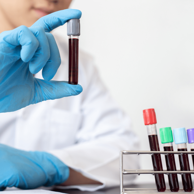 Using Young Plasma™ Exchange for Longevity - Austin Regenerative Therapy